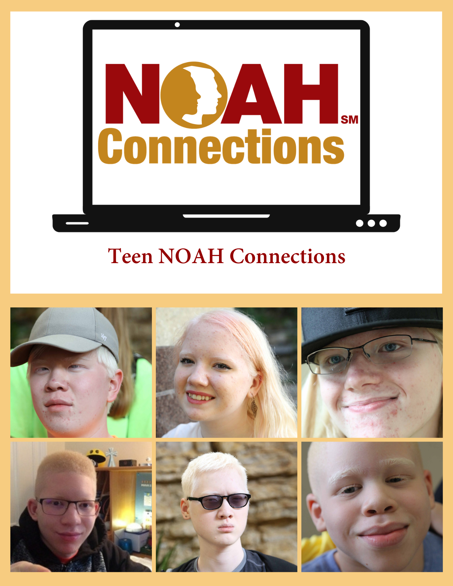 National Organization for Albinism and Hypopigmentation | Where people ...